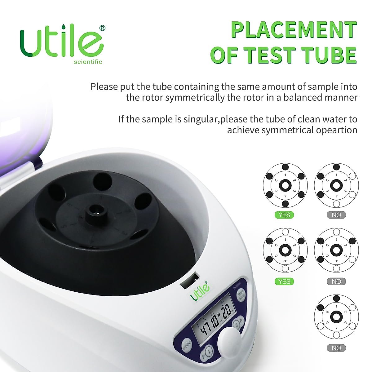 Utile Lab PRP Benchtop Centrifuge Machine with LCD Display, 6x15mL/10mL/7mL/1.5-5ml Lab Centrifuges 300-5000RPM Max. 2600xg RCF for Laboratory School, 4620.3004.1