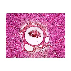 AmScope PS100A Prepared Microscope Slide Set for Basic Biological Science Education, 100 Slides, Set A, Includes Fitted Wooden Case