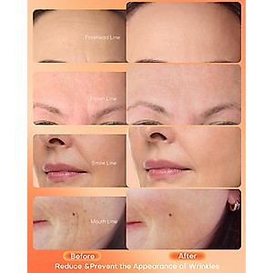 NEWKEY Red Light Therapy Mask for Face,7 Colors LED Face Mask Light Therapy, At-Home Photon Skin Care Beauty Mask for Anti Wrinkles Acne Reduction