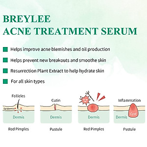Tea Tree Oil Acne Serum, BREYLEE 2.0 Treatment Acne-Prone Sensitive Skin Care Face Serum to Cystic Acne Scars, Redness Relief, Pimples Dark Spots Remove, Niacinamide Facial Moisturizer,30ml/1.01fl oz
