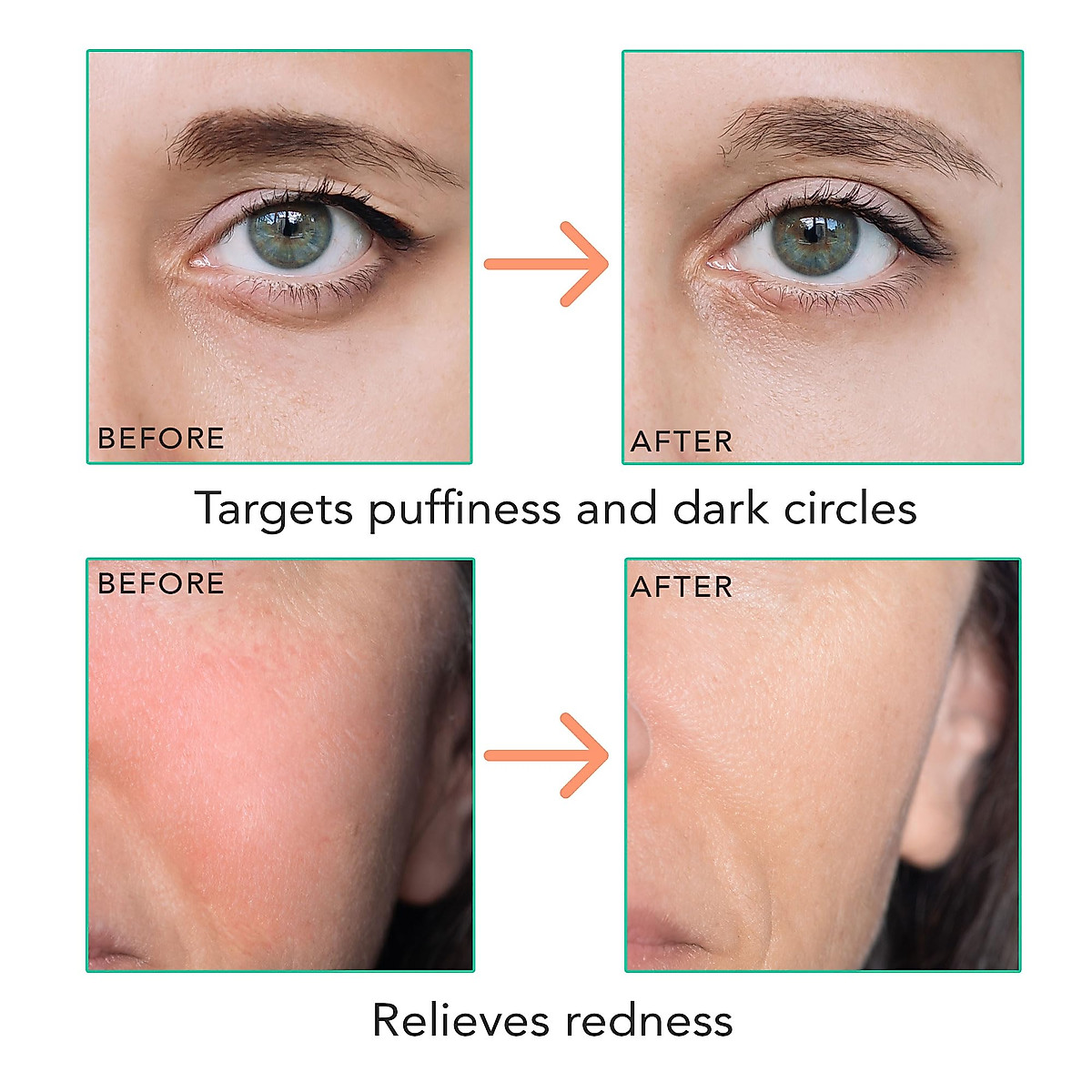 Ice Roller for Face - Smoothes Fine Lines & Wrinkles, Face & Eye Roller for Puffy Eyes, Skin Care Massager, Beauty Gift That Helps Relieve Migraines, Facial & Spa Gifts for Women