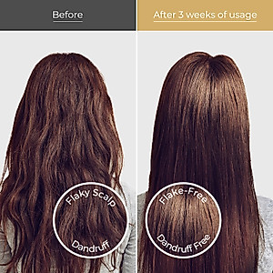 Anti Dandruff Shampoo - Sulfate-Free, Dry Scalp Soothing, Itchy Scalp Relief, Tea Tree Oil & Apple Cider Vinegar, Paraben Free Shampoo - Best Shampoo for Dandruff, Flakes, Itching & Scalp Care