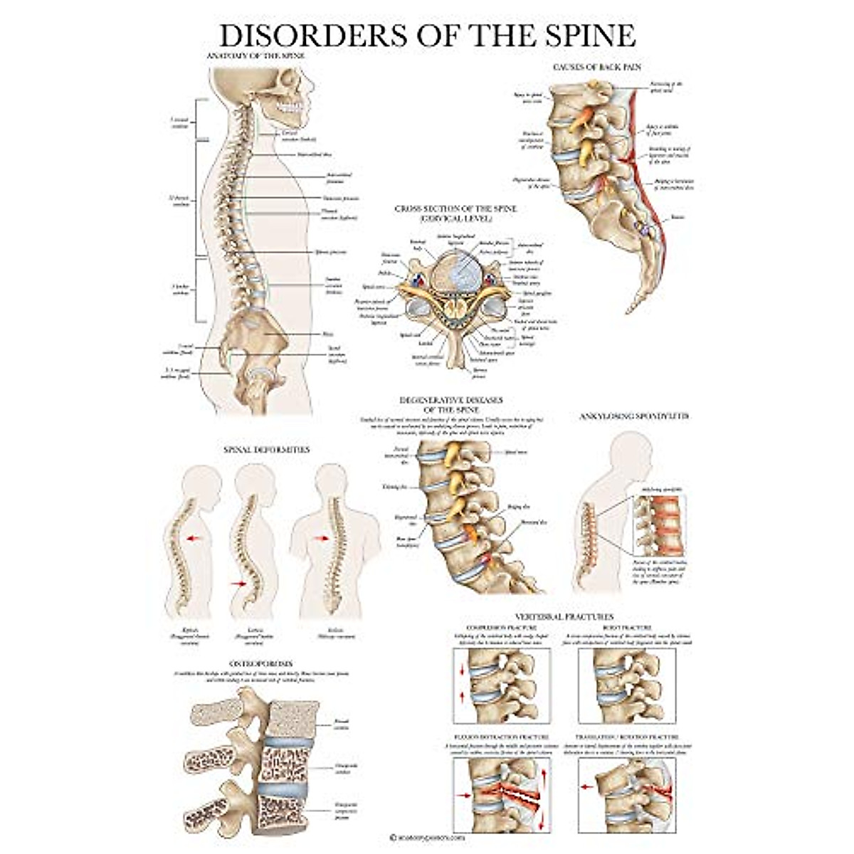 2 Pack: Spinal and Cranial Nerves + Disorders of the Spine Poster Set - Set of 2 Anatomical Charts - Laminated - 18" x 24"