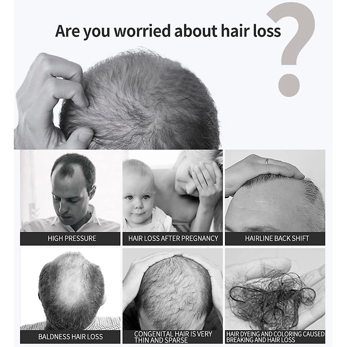 DISAAR Beauty Growth Hair Oil Spray Repair Follicles Strengthen Hair Root DHT Blocker Nourishing 30ml / 1.01fl.oz