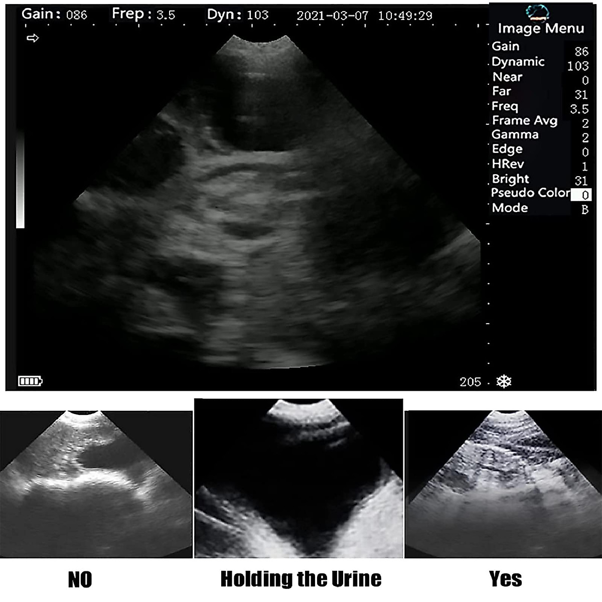 Veterinary B-Ultrasound Scanner Ultrasound Scanner for Pregnancy 6.5 MHz Rectal Probe, Volume Heart Rate Measurement with 32G TF Rechargeable, 8 Color Panels, B/BB/4B for Cattle, Horse, Camel Snake