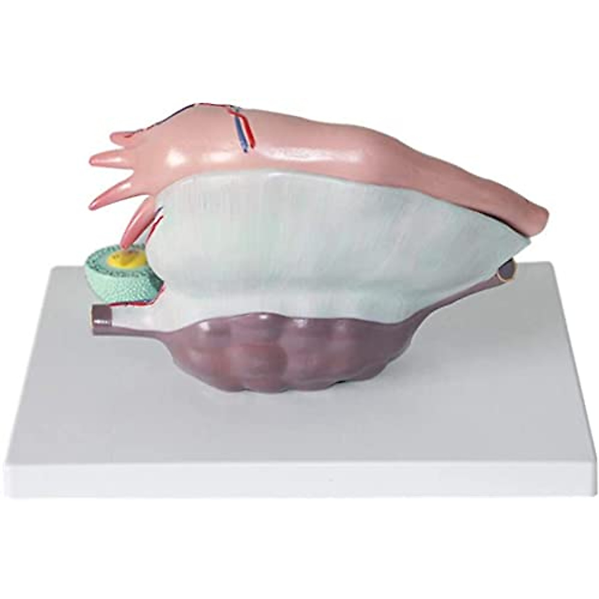 DEAVER Medical Models, Uterine Anatomy Model Ovarian Enlargement Model Skin and Genitourinary System Anatomical Medical Training Aid