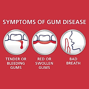 Parodontax Whitening Toothpaste for Bleeding Gums, Teeth Whitening and Gingivitis Treatment - 3.4 Ounces