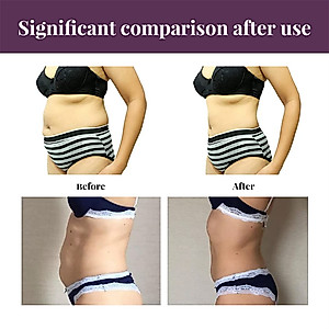 2Pcs Detoxifying Slimming Acupointtherapy Bellyring, Flower Butterfly Belly Button Rings, Lymphdrainage Bellybutton Rings, Non Piercing Acupressure Slimming Belly Button Rings (Flower)