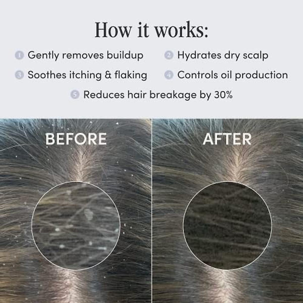 Jupiter Dandruff Shampoo & Conditioner For Dry, Oily, Itchy, Flaky Scalp - Color Safe - Sulfate, Paraben, Phthalate Free - Vegan - Premium Medicated Shampoo & Dry Scalp Conditioner - 9.5 fl oz each