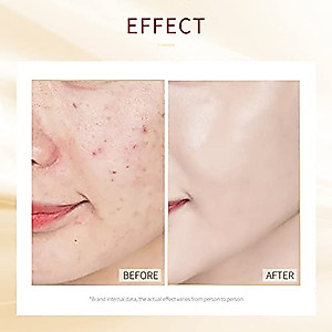 BMSY 2022 New 10 Pcs SnailSleeping Facemask Sheet Wash Frees Face Pack for Glowing Skin Deep Moisturizing Skin CareMask Firming Skin Hydrate Soothe Korean Gifts for Men and Women (Yellow, One Size)