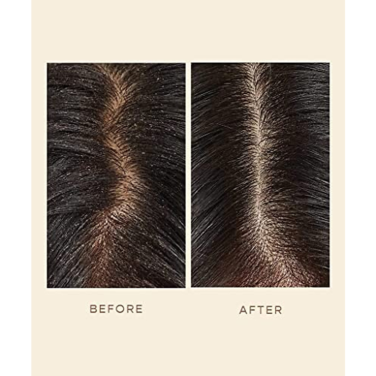 VEGAMOUR GRO Scalp Detoxifying Serum, 2 FL Ounce