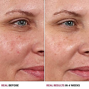 IT Cosmetics Hello Results Baby-Smooth Glycolic Acid Peel + Caring Face Oil with Argan Oil - 1.0 fl oz
