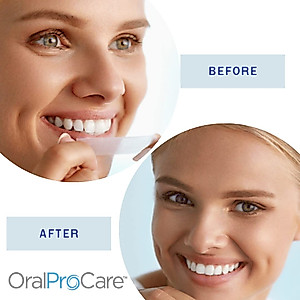 LumiSmiles Teeth Whitening Strips, Dissolving Professional Whitening Strips, 14 Treatments 28 Strips Formulated with 10% Hydrogen Peroxide. from The Makers of Lumineers