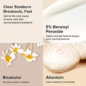 Paula's Choice CLEAR Daily Skin Clearing Treatment with Benzoyl Peroxide, Treats and Prevents Mild to Severe Acne & Breakouts, Fragrance-Free, 2.25 Fl. Oz.