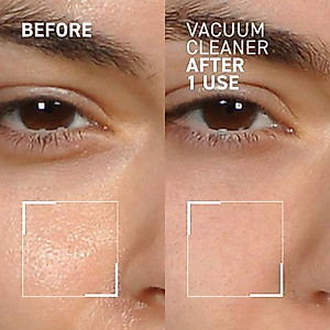 Dr. Brandt Pores No More Vacuum Cleaner - Pore-Purifying Mask to Unclog & Shrink Pores - 1 oz