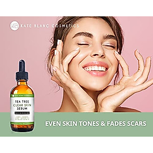 Tea Tree Serum for Face and Acne Prone Skin (1oz) by Kate Blanc Cosmetics. Tea Tree Oil Face Serum to Fight Acne Scars, Pimples, Dark Spots. Promotes Clear Skin for Teens