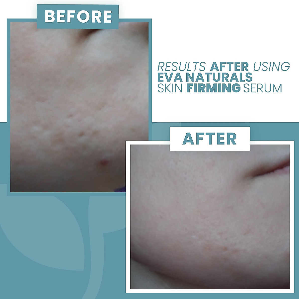 Eva Naturals Skin Firming Serum with Niacinamide and Hyaluronic Acid, 1 oz