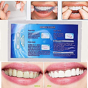 Maxlinking Advanced Teeth Whitening Strips,Gentle for Sensitive Teeth,Professional Effect to Remove Stains,Teeth Whitening for Oral Care,14 Treatment 28 Strips (14 Pairs)