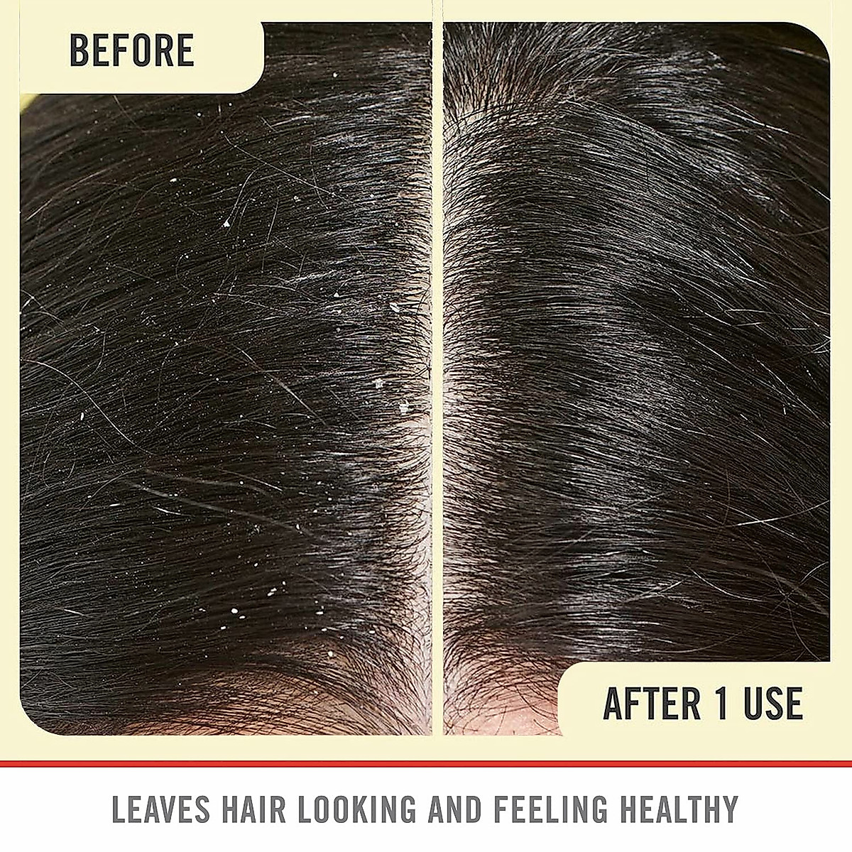 First Aid Beauty FAB Anti-Dandruff Shampoo – Fights Flakes, Soothes Scalp And Leaves Hair Looking Healthy – 8 oz