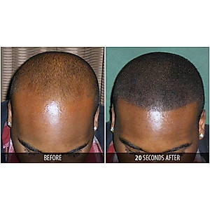 Dr. Yates MD Keratin Fiber Hair Enhancer (Dark Brown)