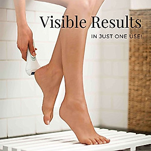 Remington Reveal Electronic Rotating Callus Remover with 2 Grit Heads (CR4000B)