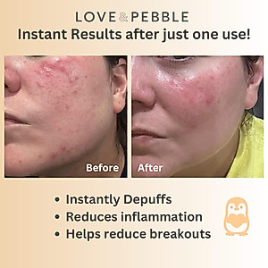 Beauty Pops by Love & Pebble- Turmeric Mask Glow Enzyme Icy Facial Kit| Viral On TikTok| As seen on Shark Tank beauty | Korean Face Mask Skincare made with turmeric, aloe, banana, papaya