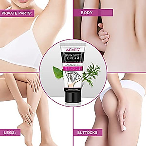 Dark Spot Cream, Natural Underarm Cream, Dark Spot Cream Corrector for Neck and Dark Spots, Sun Spots, Age Spots, Hyperpigmentation, Even Sensitive Skin-Instant Result