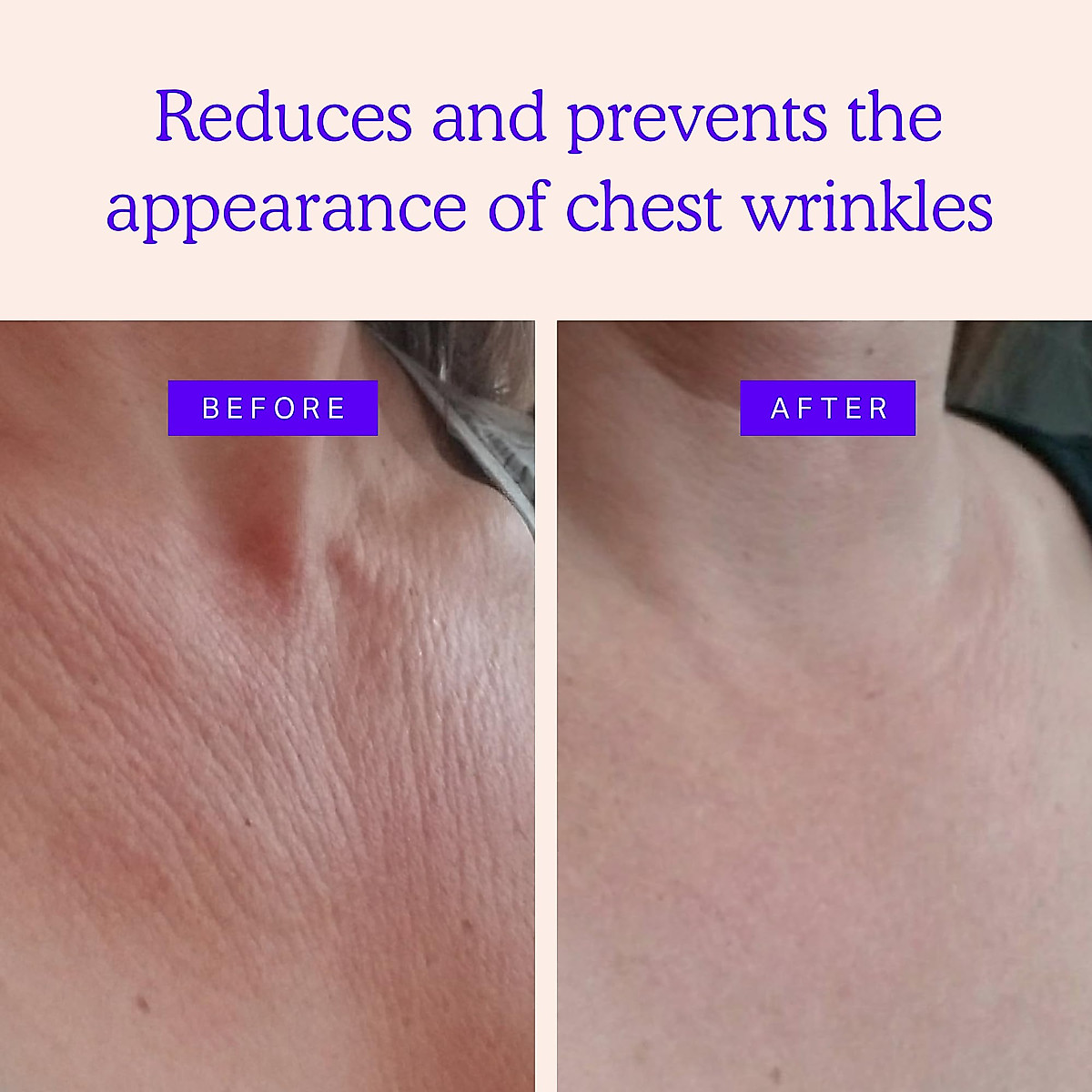 Chest Wrinkle Pads - Silicone Patches for Wrinkles - Overnight Anti Wrinkle Patches, Anti Aging Silicone Wrinkle Patches Reusable - Neck & Décolleté, Skin Safe Chest Wrinkle Patches (1-mo Supply)