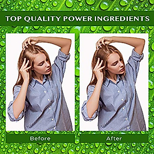 EssyNaturals Hair Growth Oil with Caffeine and Biotin - For Stronger, Thicker, Longer Hair, 1.7 oz (1 Pack)