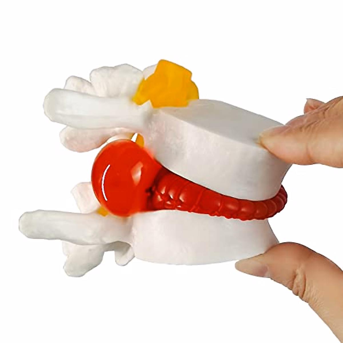 2023 New Human Anatomical Lumbar Herniation Model, Vertebrae Degenerative Lumbar Human Spine Model 1PCS,Lumbar Spine Model for Teaching & Learning - Excellent Way for Demonstrating Disc