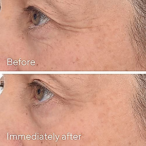 Murad Dr. Zion Retinol Youth Renewal Eye Masks – No-Slip Under Eye Patches for Fine Lines, Wrinkles, Crow’s Feet and Puffy Eyes - Full Absorption Treatment Strips, 5 Pairs