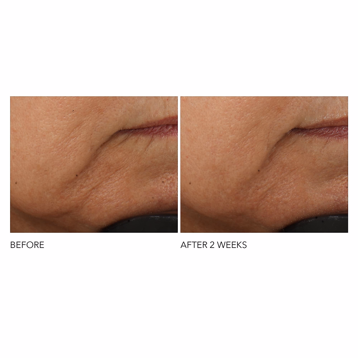 Dr Dennis Gross Advanced Retinol + Ferulic Intense Wrinkle Cream | Intensely Hydrating to Visibly Transform Skin and Repair the Moisture Barrier | 2 oz