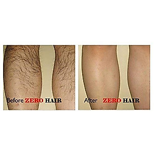 ZeroHair Painless for Women and Men Suitable for Body Skin and Private Parts Leg, Pubic, Bikini Hair Removal Premium Depilatory Cream Kachita Spell Easy Application Fast-Acting 200ml