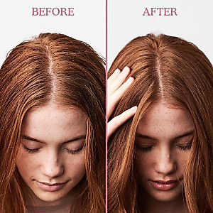 Umberto Giannini Scalp Restore Balancing Shampoo, Vegan & Cruelty Free Scalp Reviving Formula with Super Fruit Enzymes, 8.5fl Oz