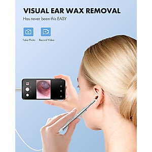 Anykit Ear Wax Removal Tool, Ultra Clear View Ear Scope with LED Lights for Ear Cleaning, Ear Cleaner Camera Otoscope with Ear Spoon & Specula for Phone & Tablet