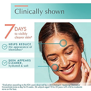 Avene Cleanance Blemish Control Starter kit for oily, blemish prone skin, acne regimen