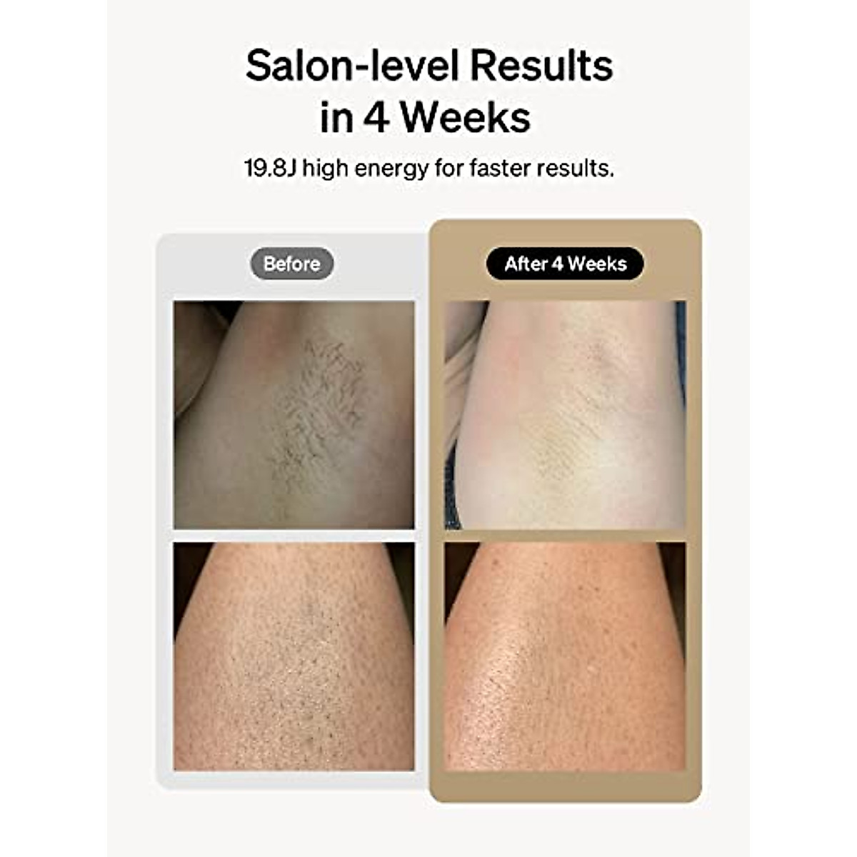 Ulike Laser Hair Removal for Women and Men, Air+ IPL Hair Removal Device with Sapphire Ice-Cooling Technology for Painless Result, Safe and Long-Lasting for Reducing in Hair Growth for Body & Face