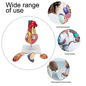 Brrnoo Human Heart Model 48 Anatomical Internal Structures, 2-Part Life Size Anatomically Accurate Numbered Heart Medical Model, 3 x Removable Parts for Teaching use