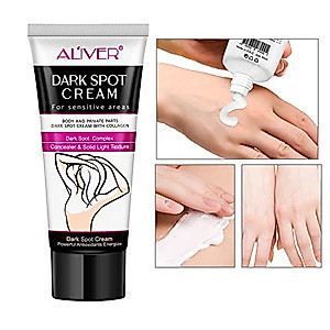 Dark Spot Cream, Natural Underarm Cream, Dark Spot Cream Corrector for Neck and Dark Spots, Sun Spots, Age Spots, Hyperpigmentation, Even Sensitive Skin-Instant Result