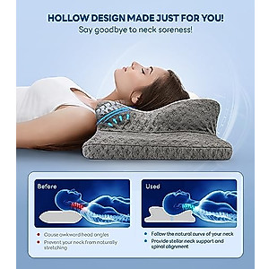 No More Aches Neck Pillow for Pain Relief, Adjustable Cervical Support with Armrest, Odorless Ergonomic Contour Memory Foam Pillows,Orthopedic Bed Side Back Stomach Sleeping