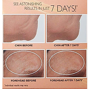 Peter Thomas Roth | Potent-C Bright & Plump Moisturizer | Brightening Vitamin C Moisturizer and Anti-Aging Cream with Collagen light blue 1.69 Fl Oz