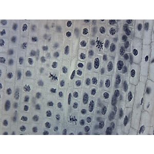 EISCO (Pack of 10) Lilium Mitosis - Prepared Microscope Slides - Classroom Pack, 10 Slides in Storage Case - Biology & Microscopy