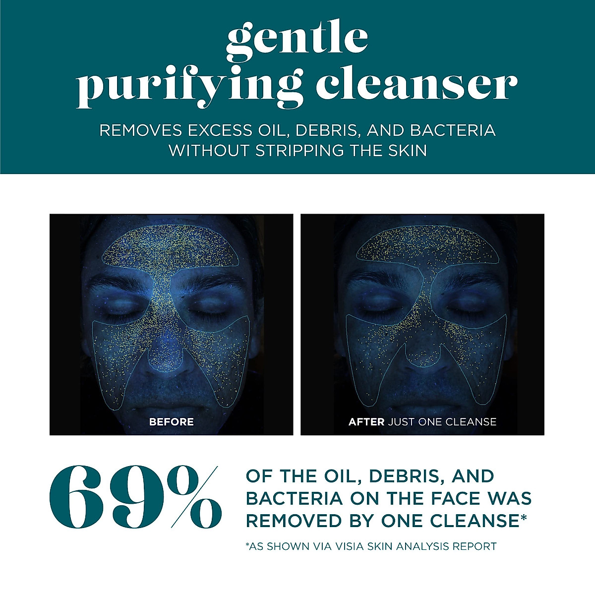 VI Derm Hydrating Gentle Purifying Cleanser, For Daily Use with Aloe Vera, Antioxidants, and Willow Bark Extract, 4 Fl Oz / 120 mL