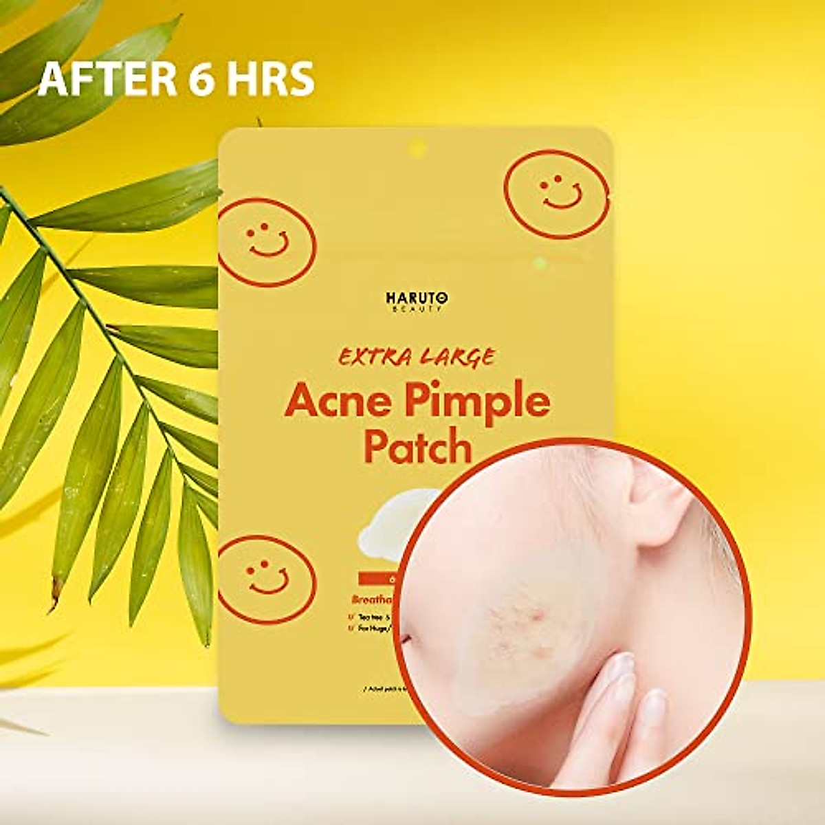 HARUTO Acne Pimple Patches XL (10 patches/1 pack) - Hydrocolloid Large acne Patches Spot Treatment, Tea tree spot patch, acne sticker for Body and Larger Breakouts,