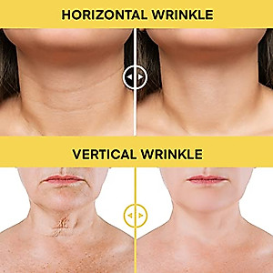 DERPHEA Neck Cream, Neck Tightening Cream, Instant Neck Firming Cream, Skin Tightening Cream To Tighten Skin, Anti Wrinkle And Fine Lines On Face, Neck, Décolleté And Body