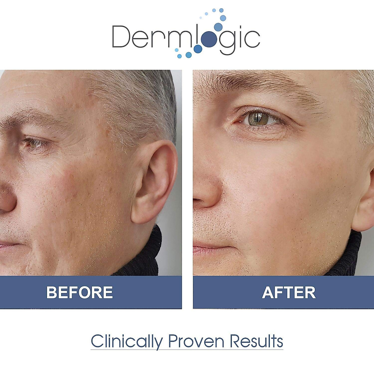 Dark Spot Corrector Cream- Visibly Fades & Repairs Marks from Dark Spots, Sunspots, Age Spots, Acne Scars, Brown Spots & Freckles for Face & Body. Safe for All Skin Types. 