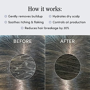 Jupiter Dandruff Shampoo & Conditioner For Dry, Oily, Itchy, Flaky Scalp - Color Safe - Sulfate, Paraben, Phthalate Free - Vegan - Premium Medicated Shampoo & Dry Scalp Conditioner - 9.5 fl oz each