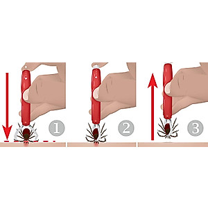 valonic tick Remover, 2 Pack - red, tick Removal Tool - tick Remover for Dogs and Cats