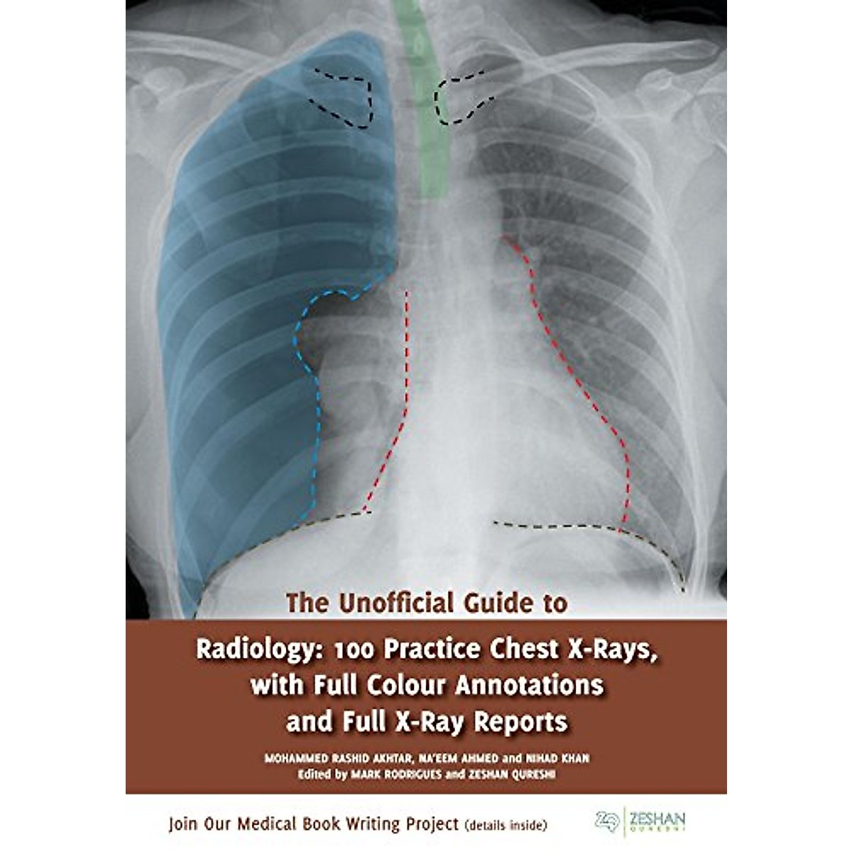 The Unofficial Guide to Radiology: 100 Practice Chest X Rays with Full Colour Annotations and Full X Ray Reports (Unofficial Guides)