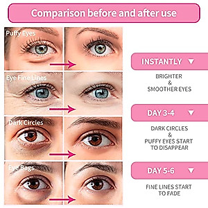 BREYLEE Rose Eye Mask– 60 Pcs - Puffy Eyes and Dark Circles Treatments – Look Younger and Reduce Wrinkles and Fine Lines Undereye, Improve and Firm eye Skin - Pure Natural Material Extraction